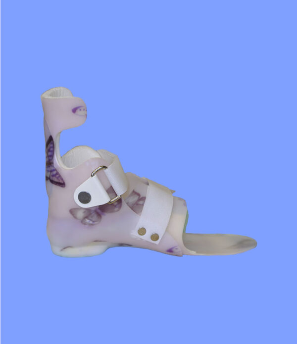 Pediatric SMOs for Improved Support and Mobility in Children