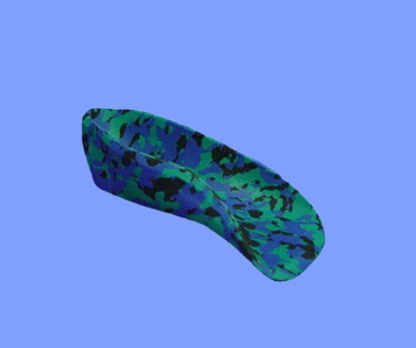 UCBL Orthotic - Custom Foot Support for Enhanced Stability and Comfort